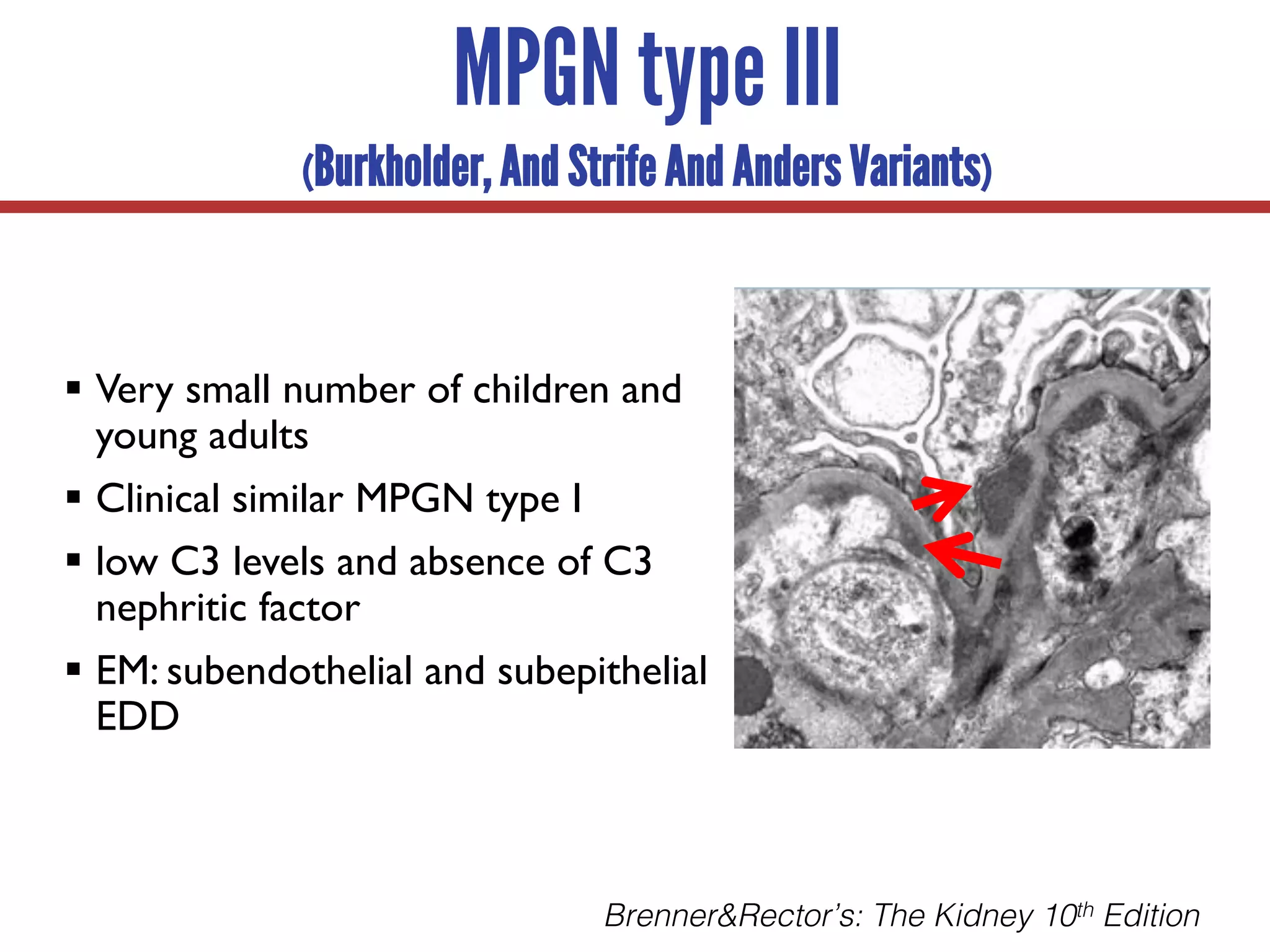 Membranoproliferative Glomerulonephritis MPGN chaken | PDF