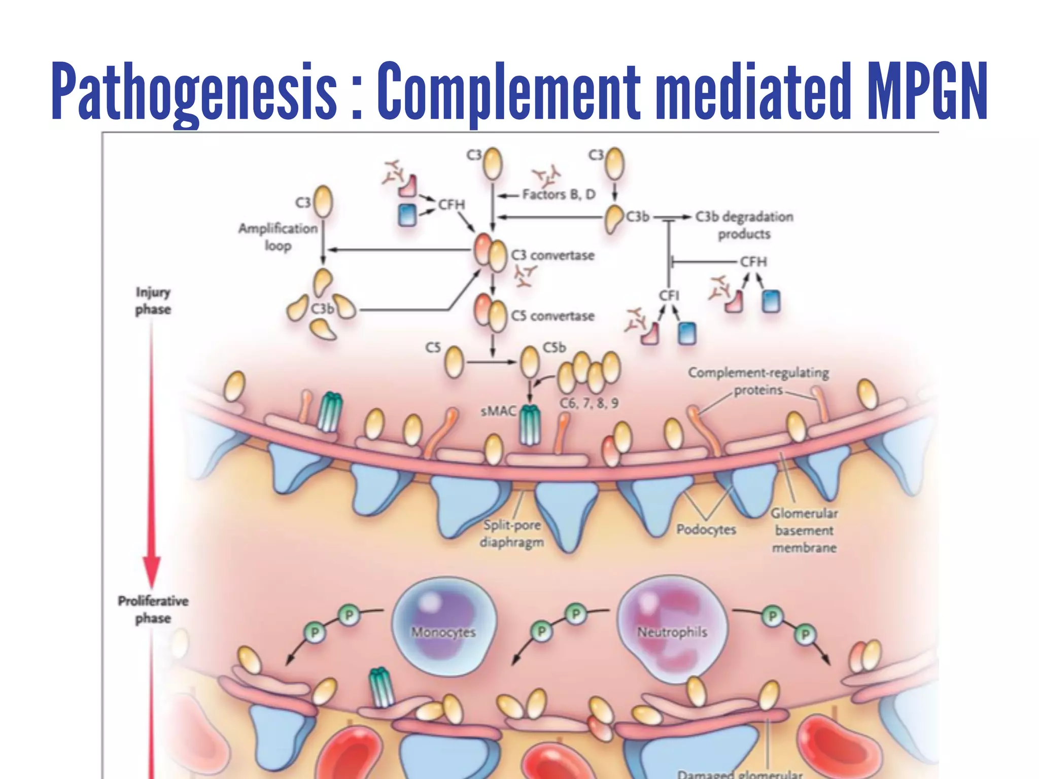 Membranoproliferative Glomerulonephritis MPGN chaken | PDF