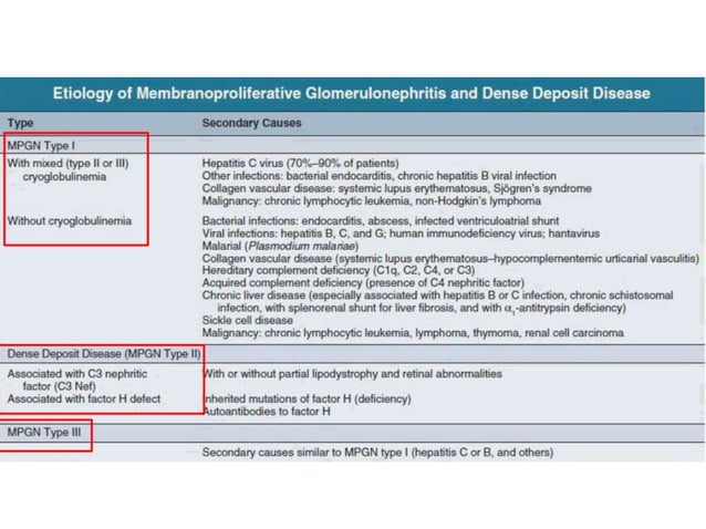 Membranoproliferative Glomerulonephritis MPGN chaken | PPT