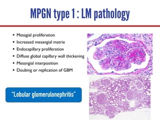 Membranoproliferative Glomerulonephritis Type 1