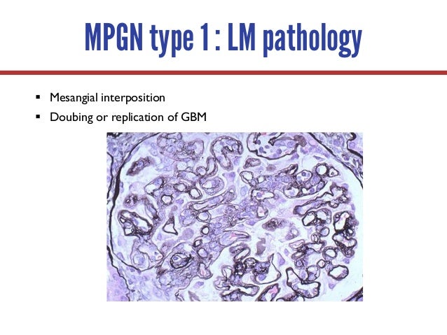 Membranoproliferative Glomerulonephritis MPGN chaken