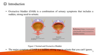 Formulation and Evaluation of Immediate Release Tablet for Treatment of ...