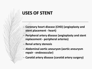 Manufacturing of stents | PPT