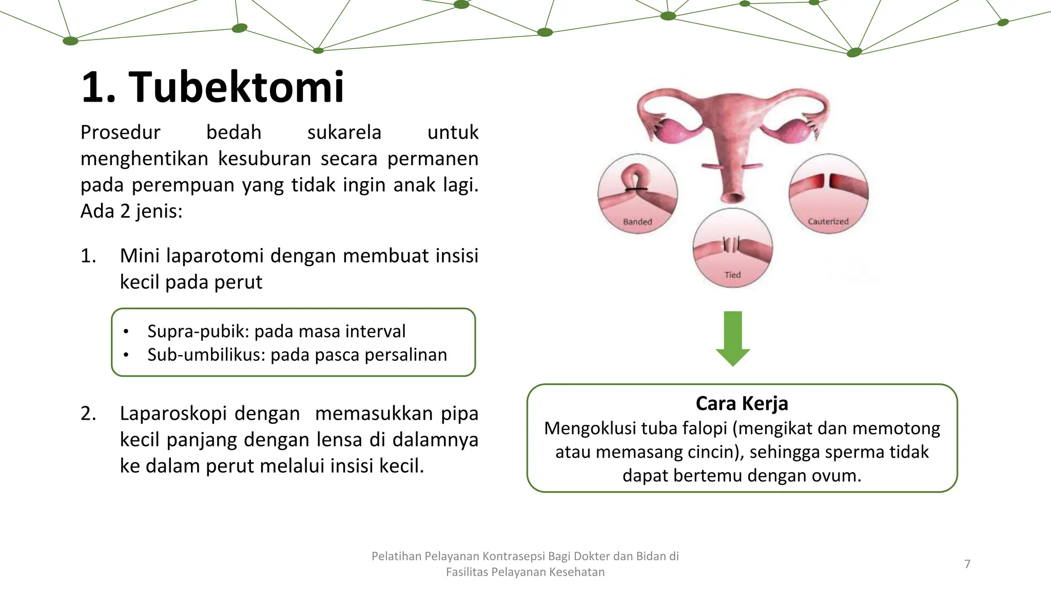 MPI 3 Pelayanan Kontrasepsi Lampung.pptx