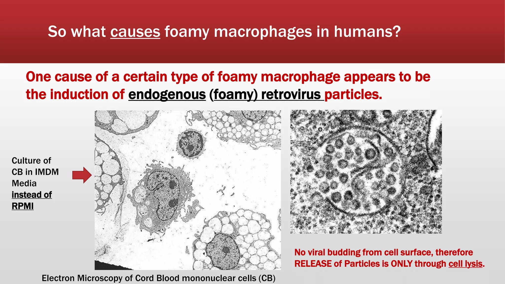 Atherosclerosis: New Insights on Foamy Macrophage Induction and ...