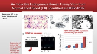 Atherosclerosis: New Insights on Foamy Macrophage Induction and ...