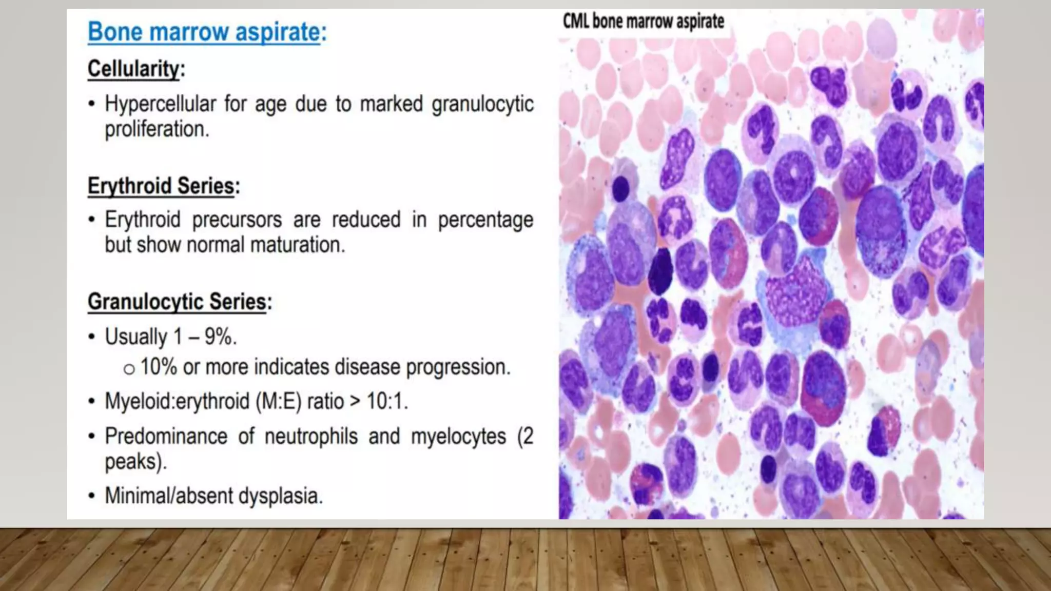 Myeloproliferative Neoplasm | PPTX