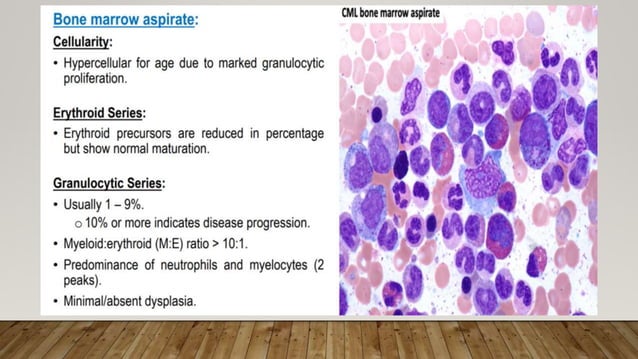 Myeloproliferative Neoplasm | PPTX