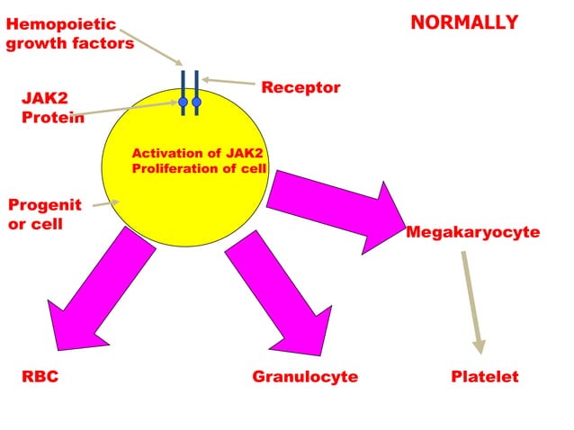 MPNs; Definition, Types of MPN Mutations, Aetiology, Clinical features ...