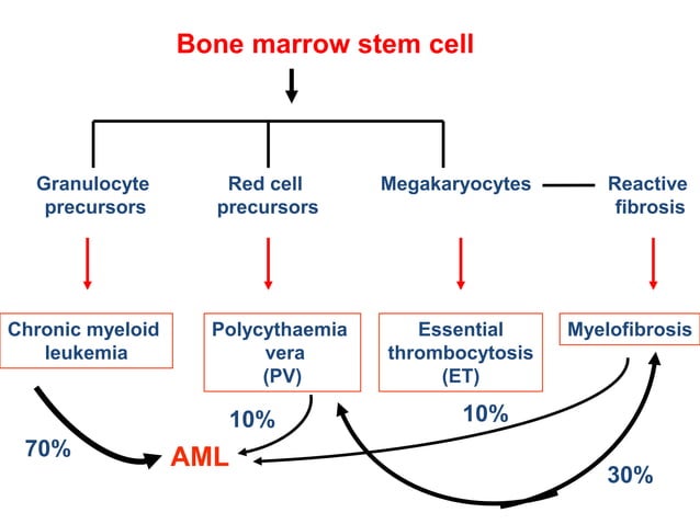 MPNs; Definition, Types of MPN Mutations, Aetiology, Clinical features ...