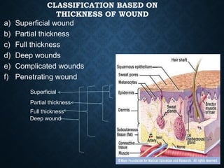 introduction to wound healing orthopaedics | PPTX