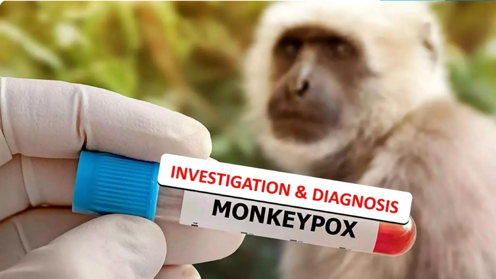 Monkey PoX disease overview and management.pptx