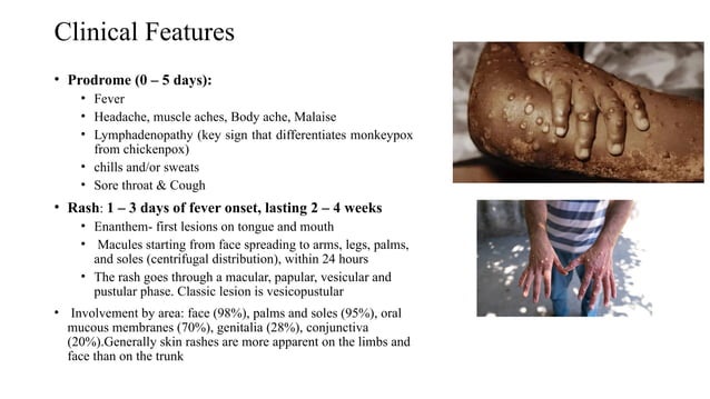 mpox final.pptx MPOX GUIDELINES MPOX FINAL PPT | PPTX