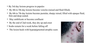 mpox final.pptx MPOX GUIDELINES MPOX FINAL PPT | PPTX