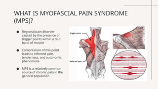 Myofascial Pain Syndrome Rehab Recommendations | PPTX
