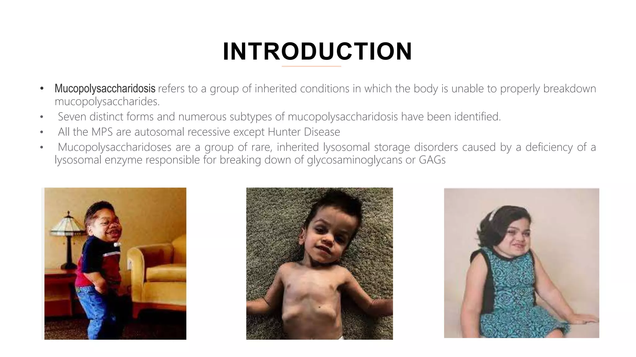 mucopolysaccharidosis