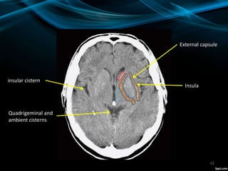 Neuroimaging | PPTX