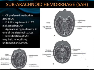 Neuroimaging | PPTX