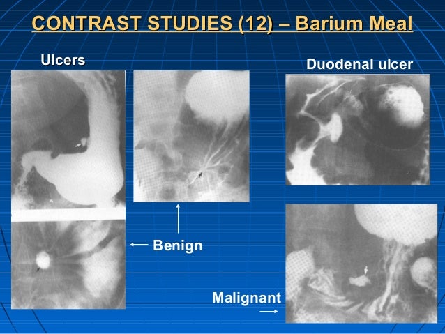 Imaging of the abdomen & the gastrointestinal