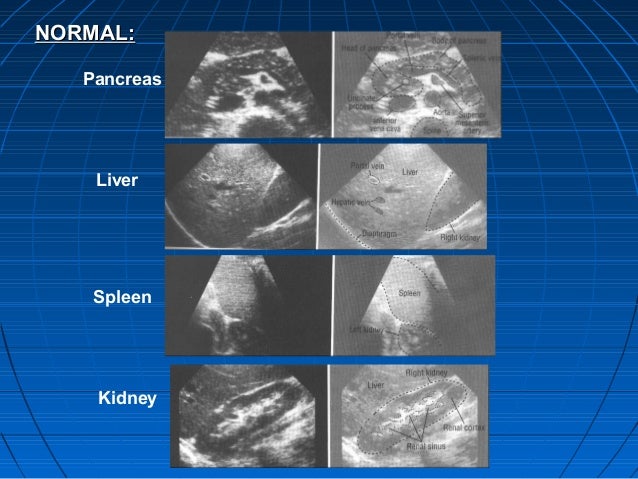 Imaging of the abdomen & the gastrointestinal