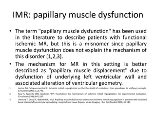 Mitral regurgitation | PPTX