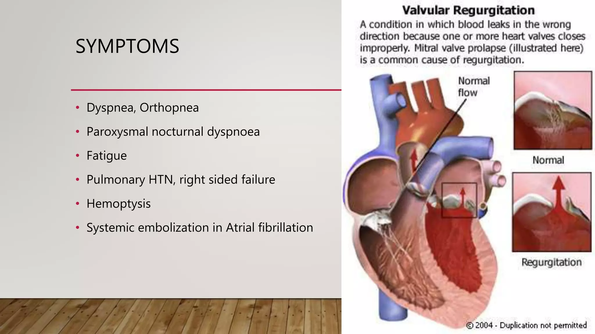 Mitral Regurgitation in Rheumatic Heart Disease | PPT