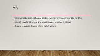 Mitral Regurgitation in Rheumatic Heart Disease | PPT