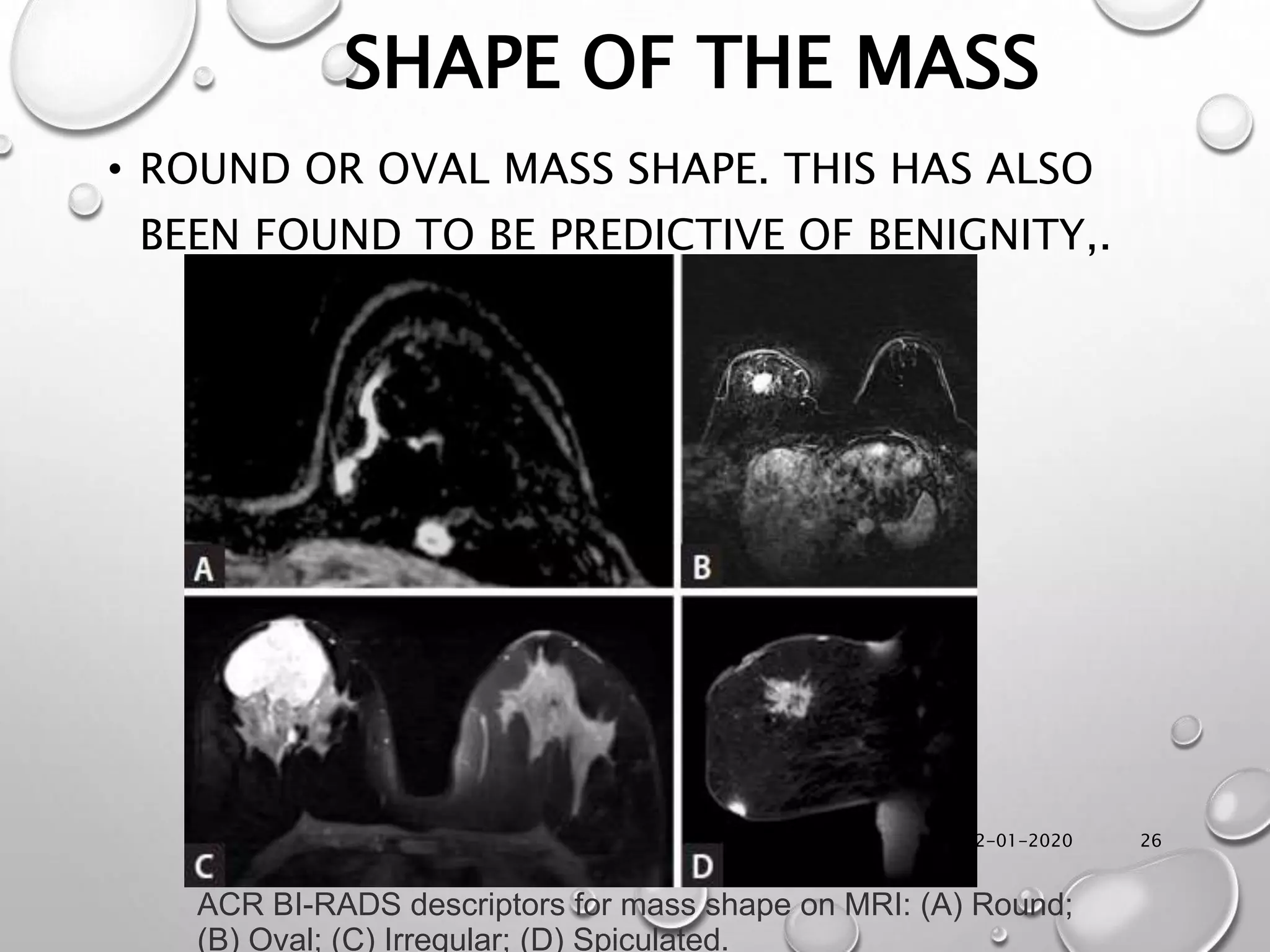 MRI BREAST PPT | PPTX