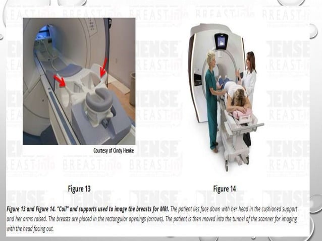 MRI BREAST PPT | PPTX