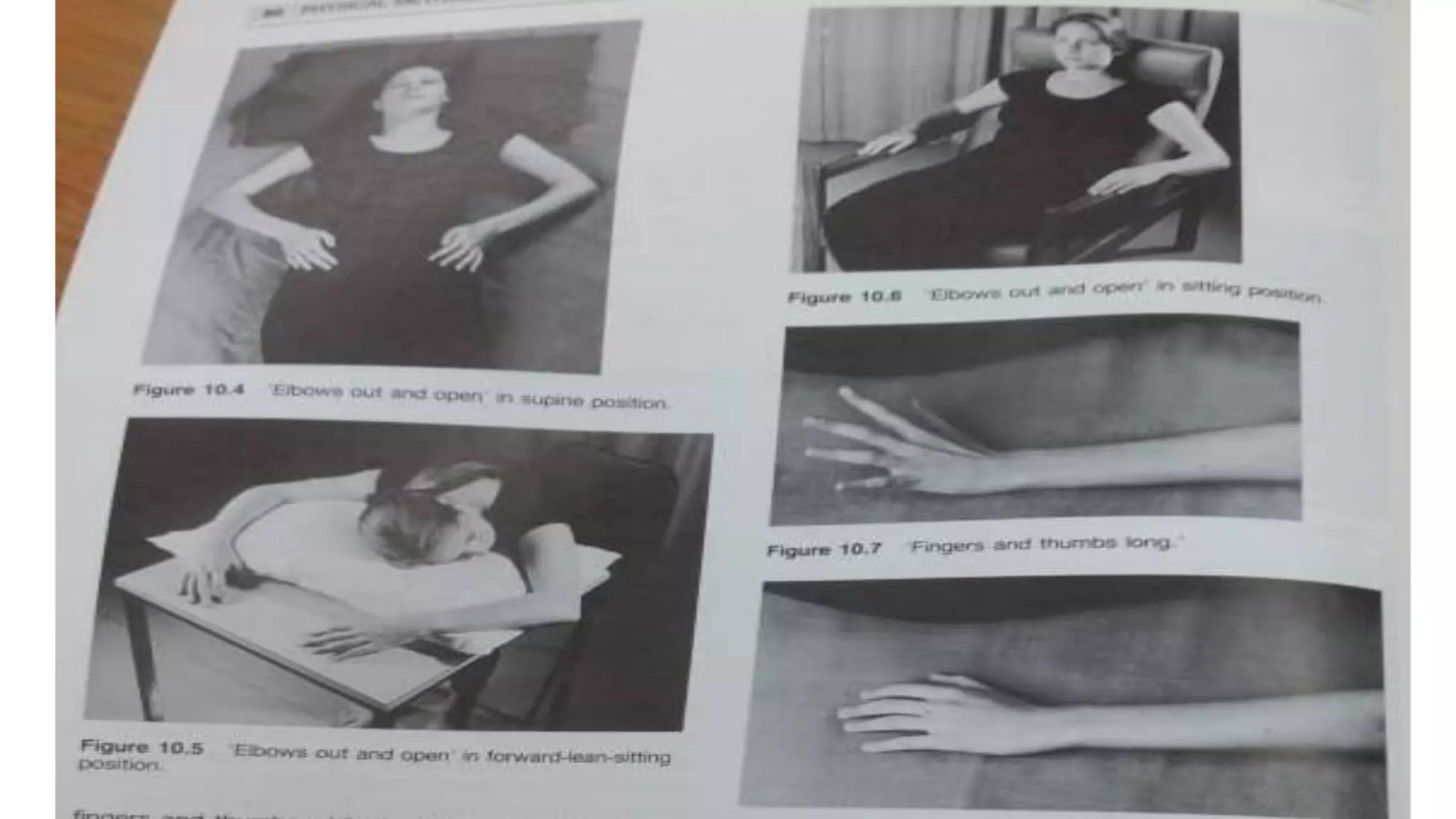 MITCHELL’S RELAXATION TECHNIQUE | PDF