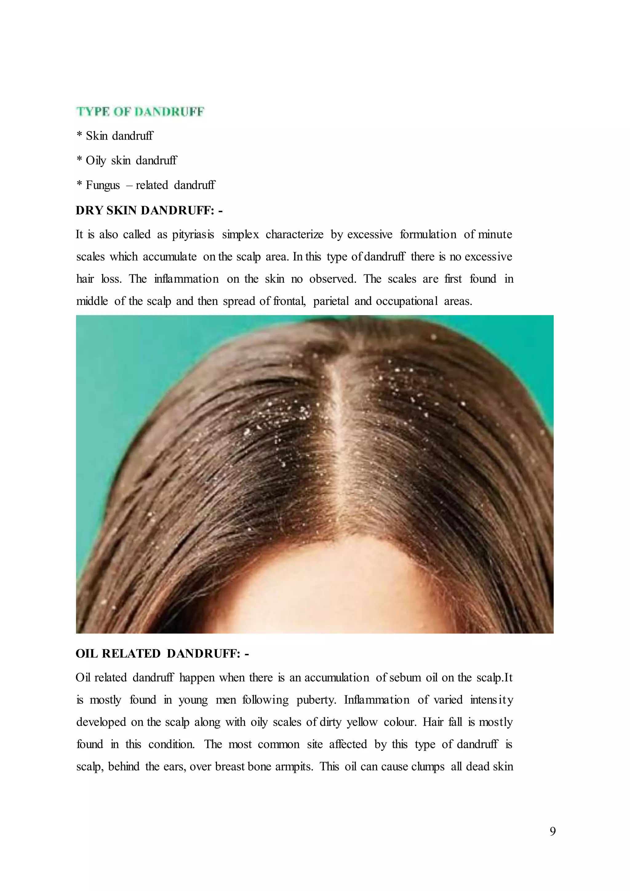 SHAMPOO project Report(Mr.DINESH KUMAR) | DOCX