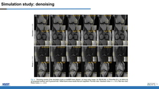 mr-denoising-and-super-resolution-using-regularized-reverse-diffusion.pptx