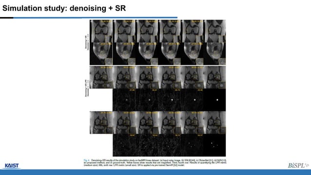 mr-denoising-and-super-resolution-using-regularized-reverse-diffusion.pptx