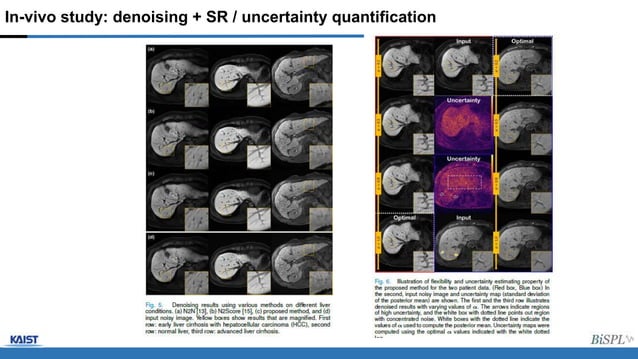 mr-denoising-and-super-resolution-using-regularized-reverse-diffusion.pptx