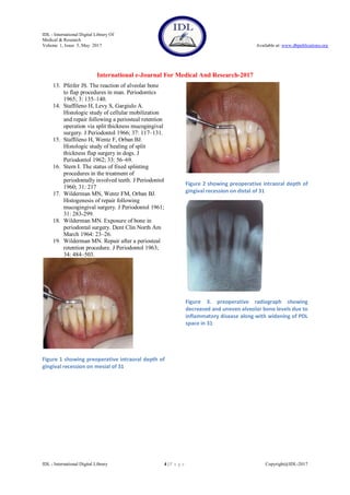 Temporary Splinting in secondary trauma from occlusion followed by ...