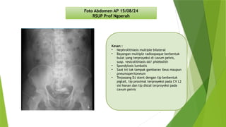 mr pasienenn end 18dhdaaaaacccccccccccccccaaac | PPT