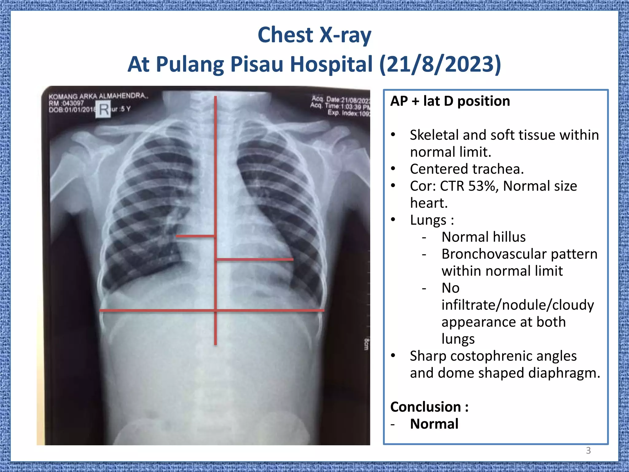 MR 21 Agu - GNAPS.pptx