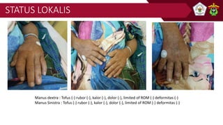 MR 4 Periode maret arthritis gout akut.pptx