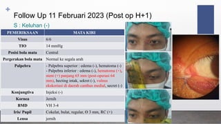 Morning report presentation ophthalmology cases | PPTX