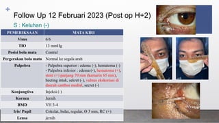 Morning report presentation ophthalmology cases | PPTX