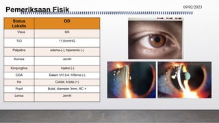 Morning report presentation ophthalmology cases | PPTX