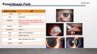 Morning report presentation ophthalmology cases | PPTX