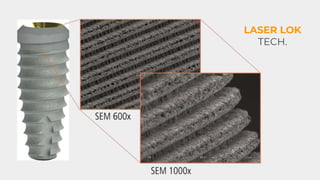 Biohorizons Implant System Overview | PPTX
