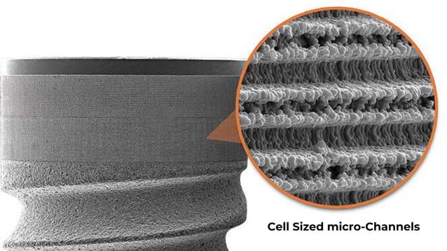 Biohorizons Implant System Overview | PPTX | Technology & Computing