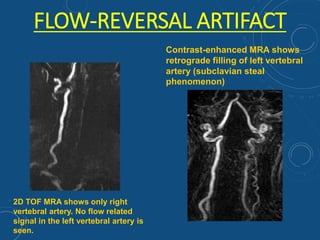 Magnetic Resonance Angiography and techniques | PPTX