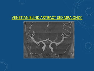 Magnetic Resonance Angiography and techniques | PPTX