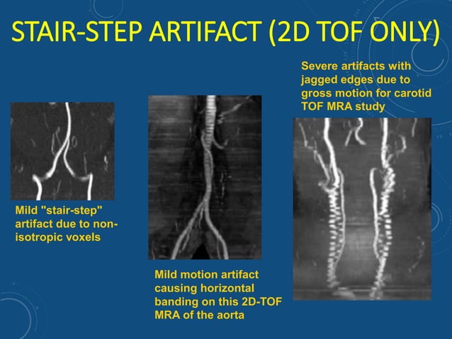 Magnetic Resonance Angiography and techniques | PPTX