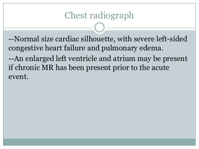 Normal Lv Size With Hyperdynamic Systolic Function | semashow.com