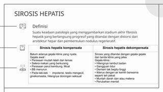 sirosis hepatis morning reports jhsjshjkhwejh | PPTX