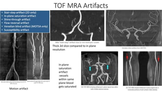 Magnetic Resonance Angiography of head and neck.pptx